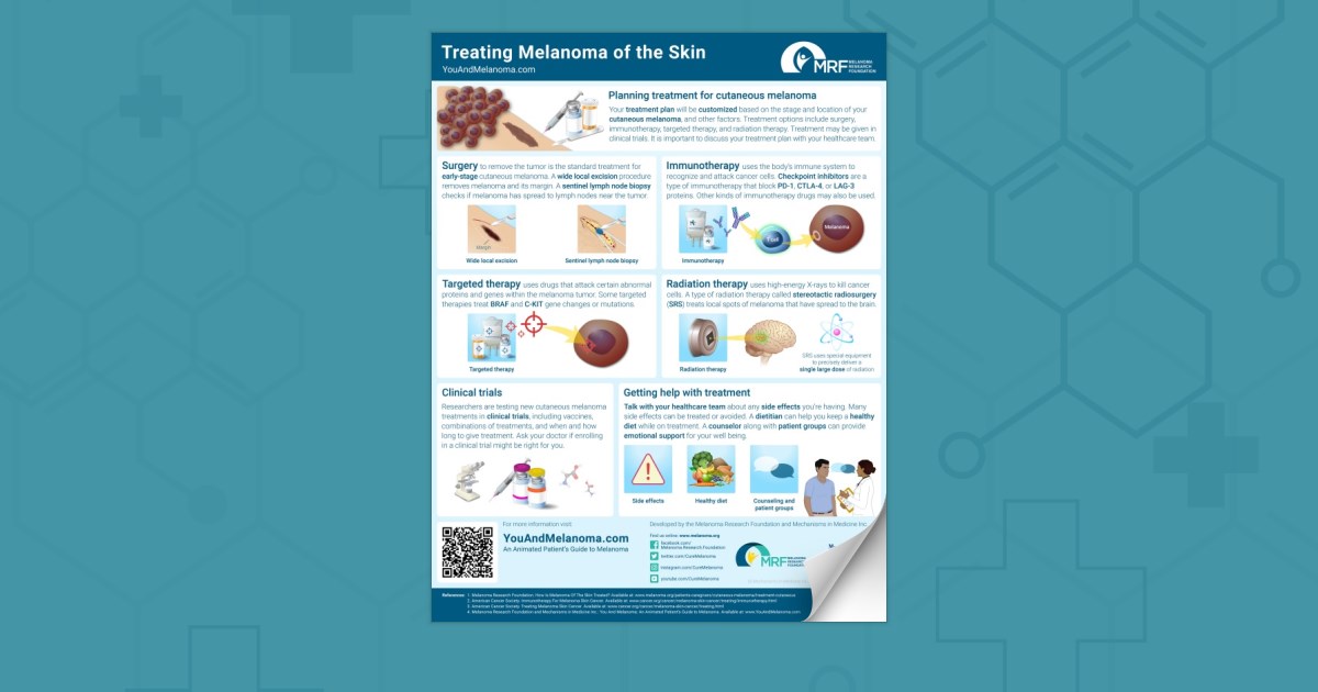 Treating Melanoma of the Skin